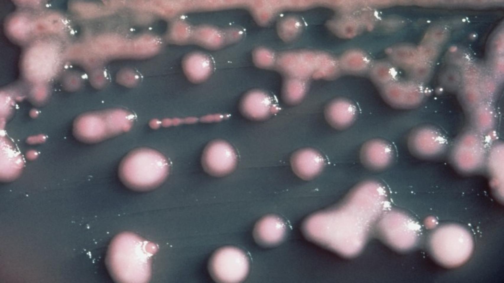 La bacteria que ha mutado a 'súperbacteria' y amenaza a los hospitales ...