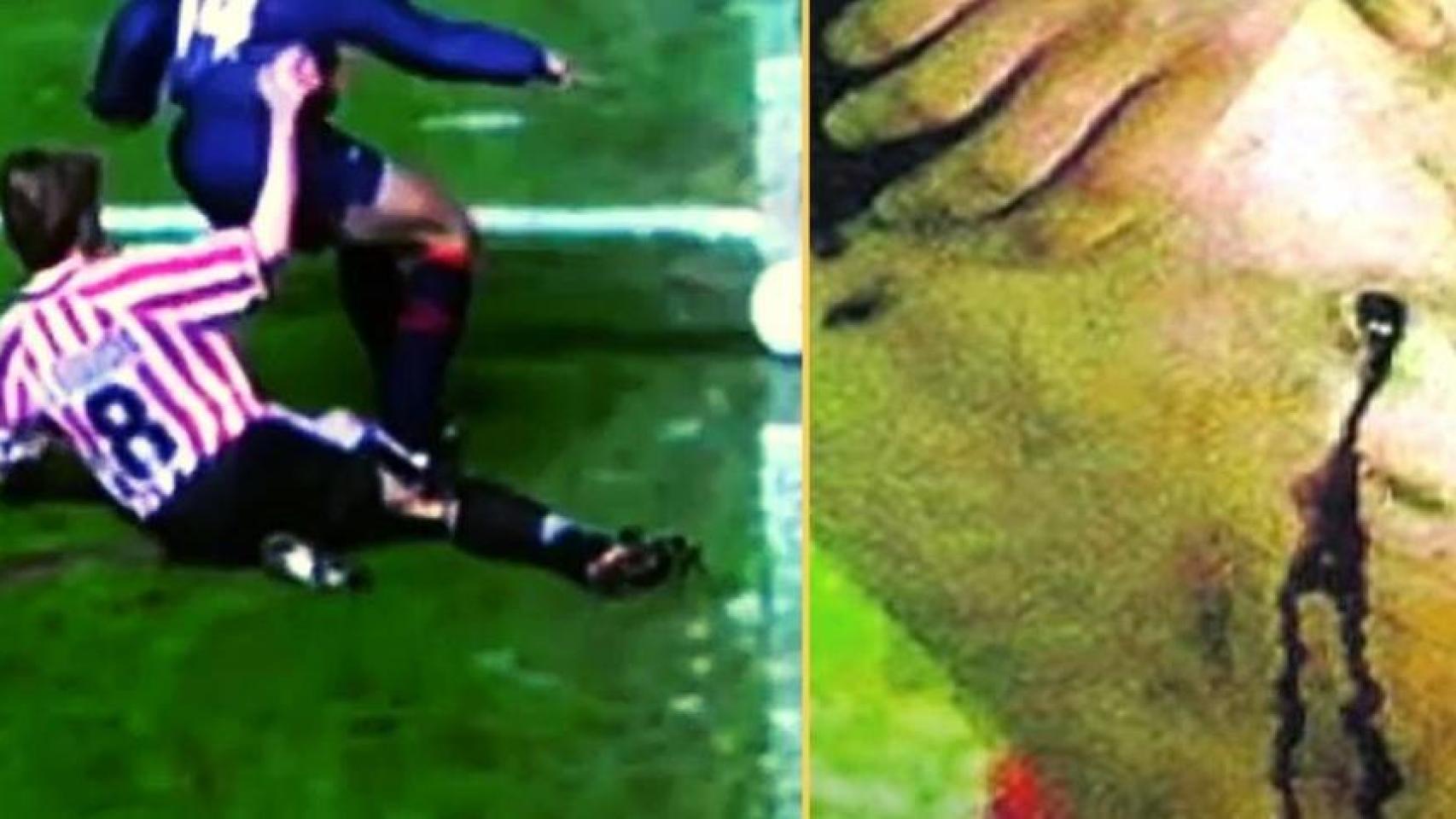 Simeone rompe su silencio sobre su pisotón a Julen Guerrero: "Estuvo ...